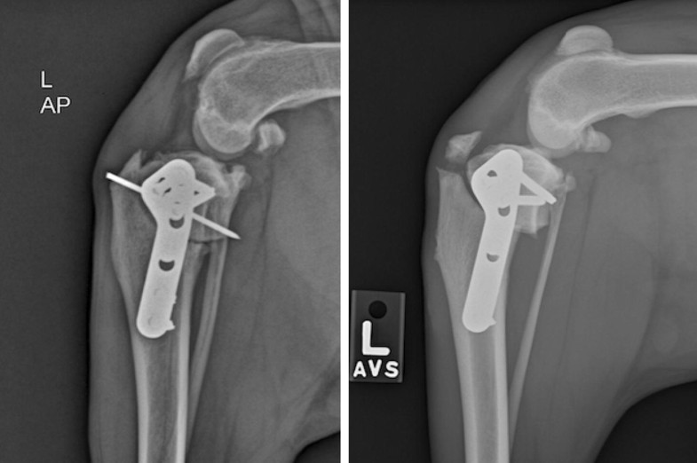Comparison of TPLO tibial tuberosity fractures with and without an in ...