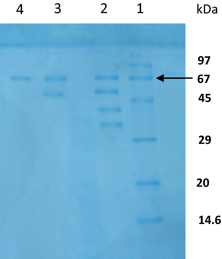 Screening, purification and characterization of cellulase from ...
