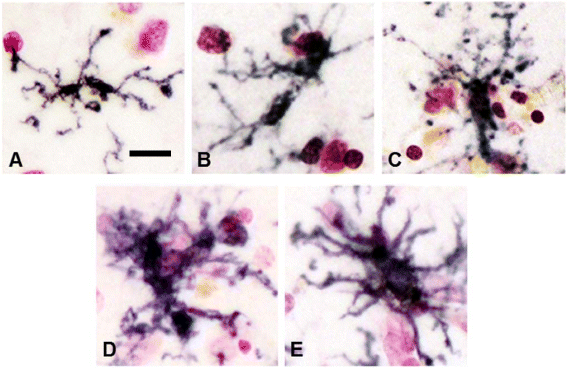 Immune phenotypes of microglia in human neurodegenerative disease ...