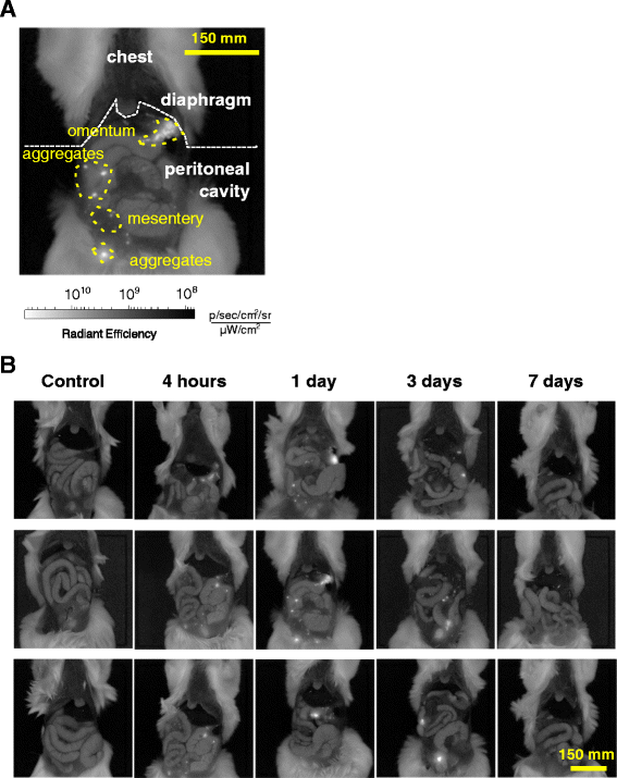 Intraperitoneally infused human mesenchymal stem cells form aggregates ...