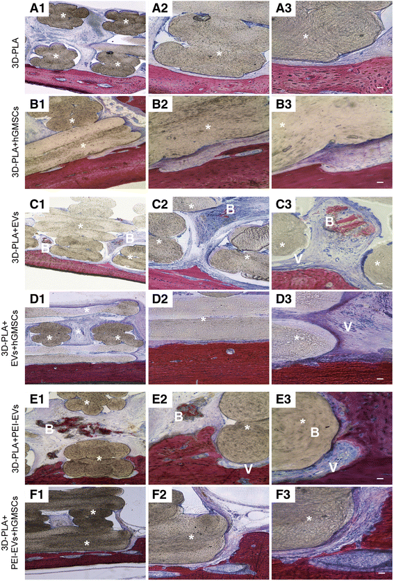 Three-dimensional printed PLA scaffold and human gingival stem cell-derived extracellular ...