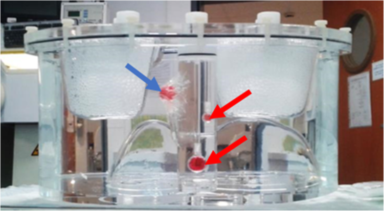 223Ra-dichloride therapy of bone metastasis: optimization of SPECT ...