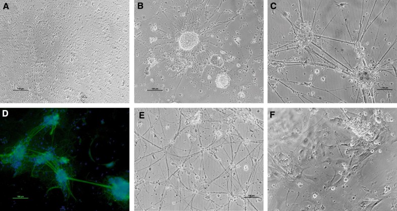 Betanodavirus infection in primary neuron cultures from sole ...