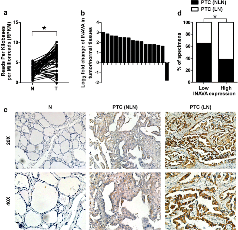INAVA promotes aggressiveness of papillary thyroid cancer by ...