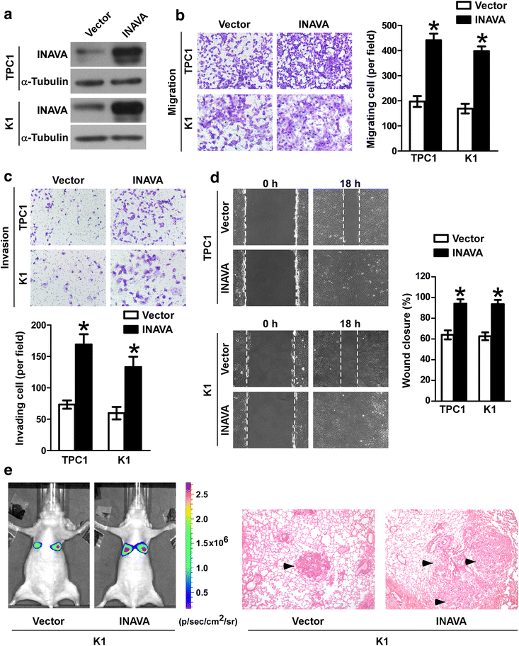INAVA promotes aggressiveness of papillary thyroid cancer by ...