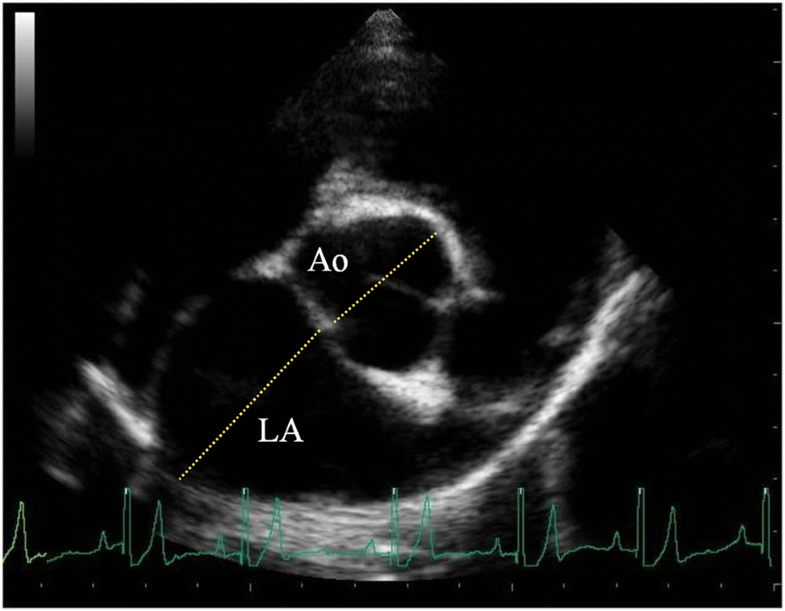 A radiographic measurement of left atrial size in dogs | Irish ...