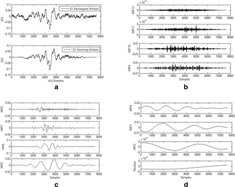 Localization and classification of heart beats in phonocardiography ...