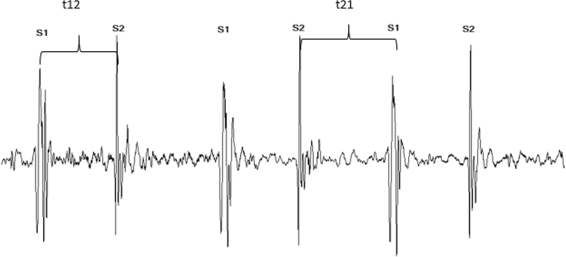 Localization and classification of heart beats in phonocardiography ...