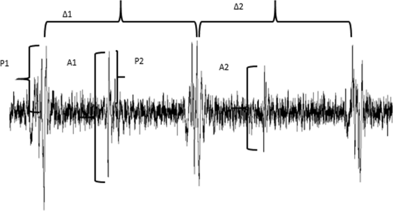 Localization and classification of heart beats in phonocardiography ...