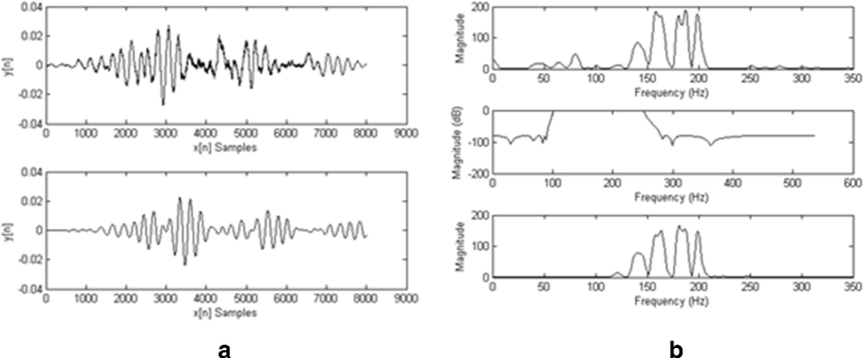 Localization and classification of heart beats in phonocardiography ...