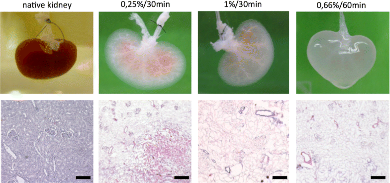 Optimized protocol for whole organ decellularization | European Journal ...