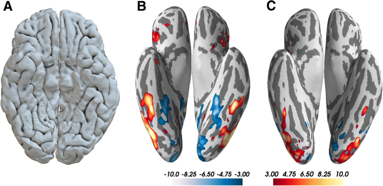 The hidden identity of faces: a case of lifelong prosopagnosia | BMC ...