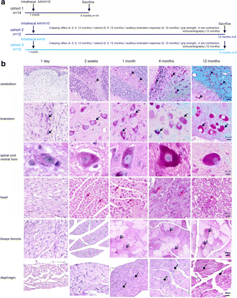 Long-term neurologic and cardiac correction by intrathecal gene therapy ...