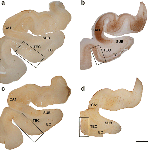 Three-dimensional analysis of synapses in the transentorhinal cortex of ...