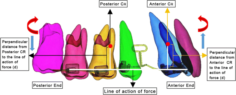 Comparative assessment of the efficacy of closed helical loop and T ...