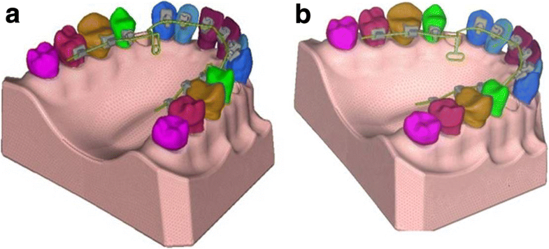 Comparative assessment of the efficacy of closed helical loop and T ...
