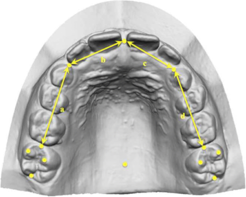Early diagnosed impacted maxillary canines and the morphology of the ...