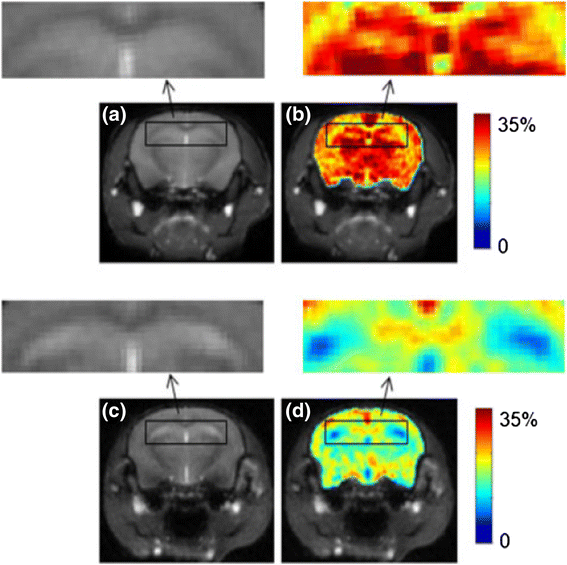 An overview of CEST MRI for non-MR physicists | EJNMMI Physics | Full Text