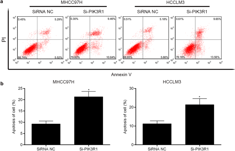 Overexpression of PIK3R1 promotes hepatocellular carcinoma progression ...