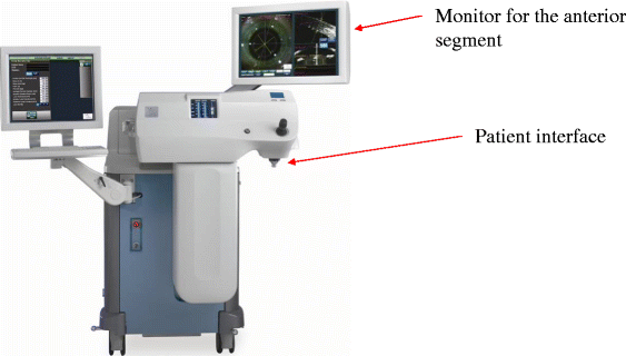 Femtosecond laser cataract surgery | Eye and Vision | Full Text
