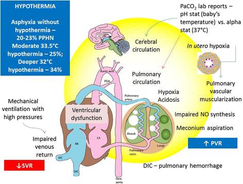 Persistent pulmonary hypertension of the newborn | Maternal Health ...