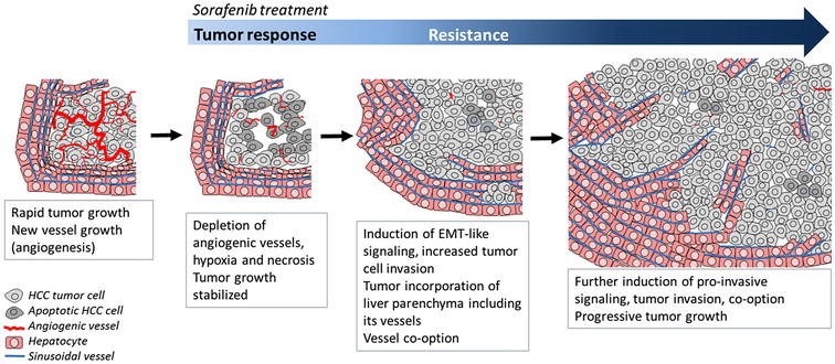 Implications of vessel co-option in sorafenib-resistant hepatocellular ...