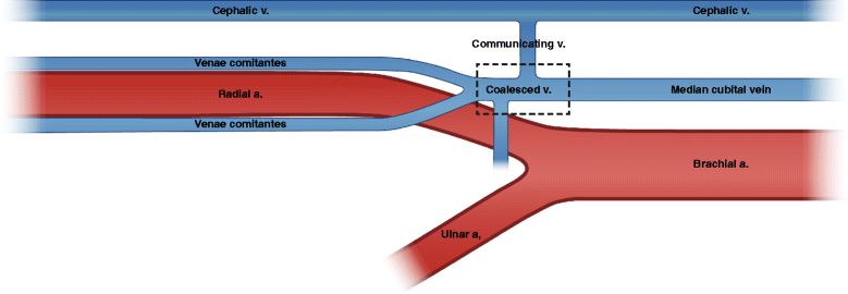 Revisiting radial forearm free flap for successful venous drainage ...