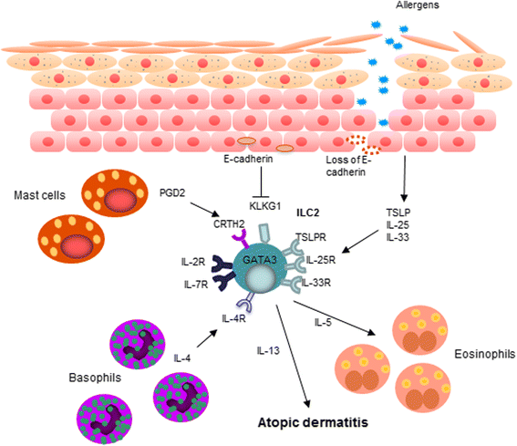 The etiopathogenesis of atopic dermatitis: barrier disruption ...
