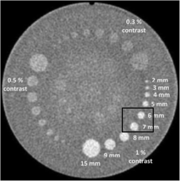 A simple method for low-contrast detectability, image quality and dose ...
