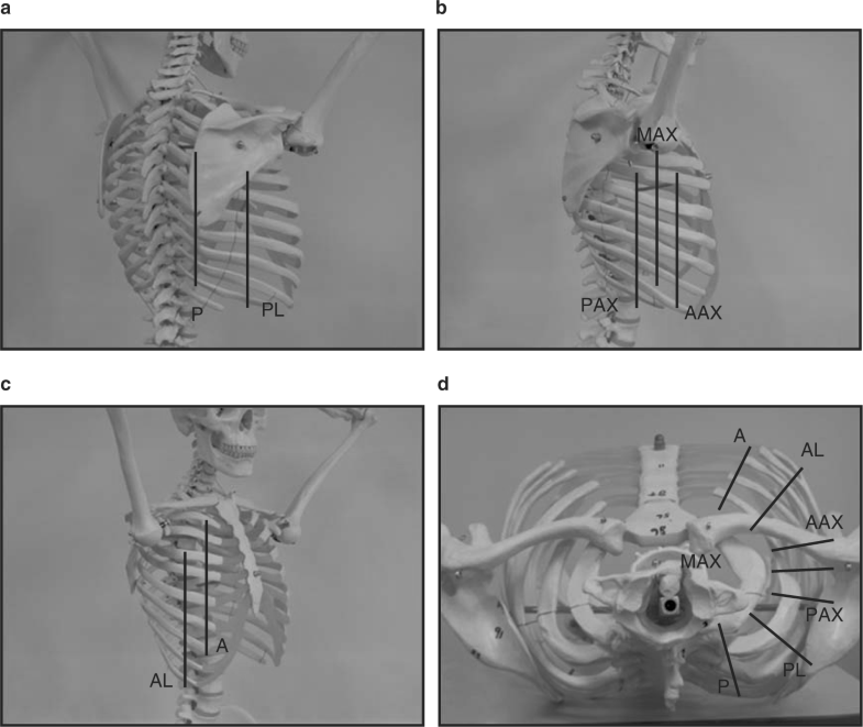 Rib Stress Fractures Among Rowers | SpringerLink