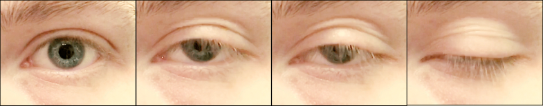 Preprocessing pupil size data: Guidelines and code | SpringerLink