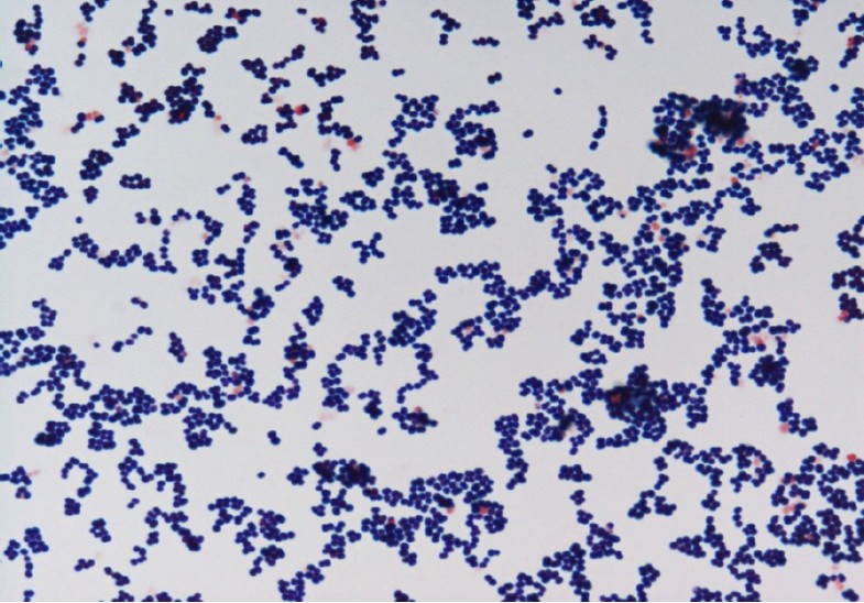 Non-contiguous finished genome sequence and description of Anaerococcus ...