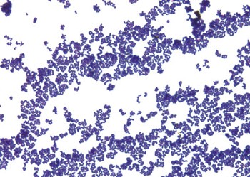 The Genus Corynebacterium--Medical | SpringerLink