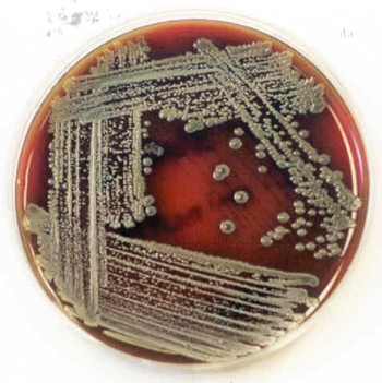 The Genus Corynebacterium--Medical | SpringerLink