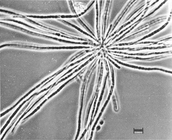 The Genus Leucothrix | SpringerLink