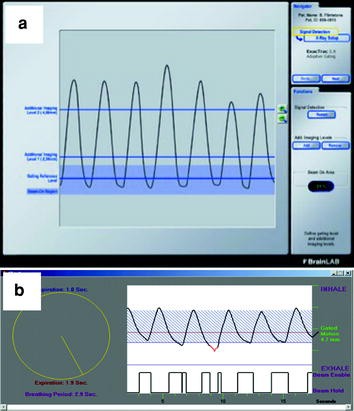 Novalis and Varian Systems | SpringerLink