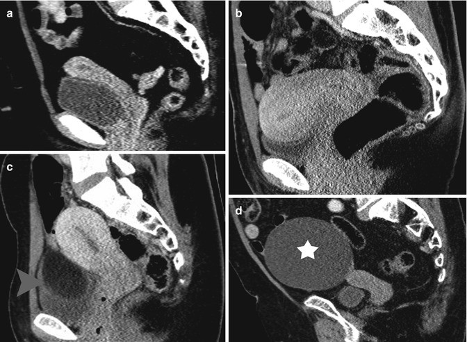 Uterus: Normal Findings | SpringerLink