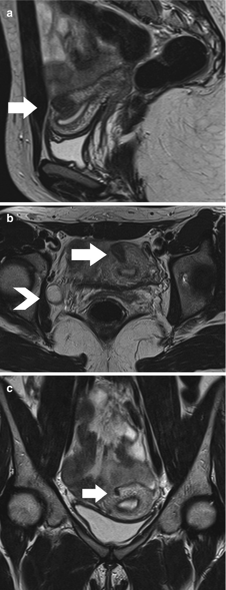 Uterus: Normal Findings | SpringerLink