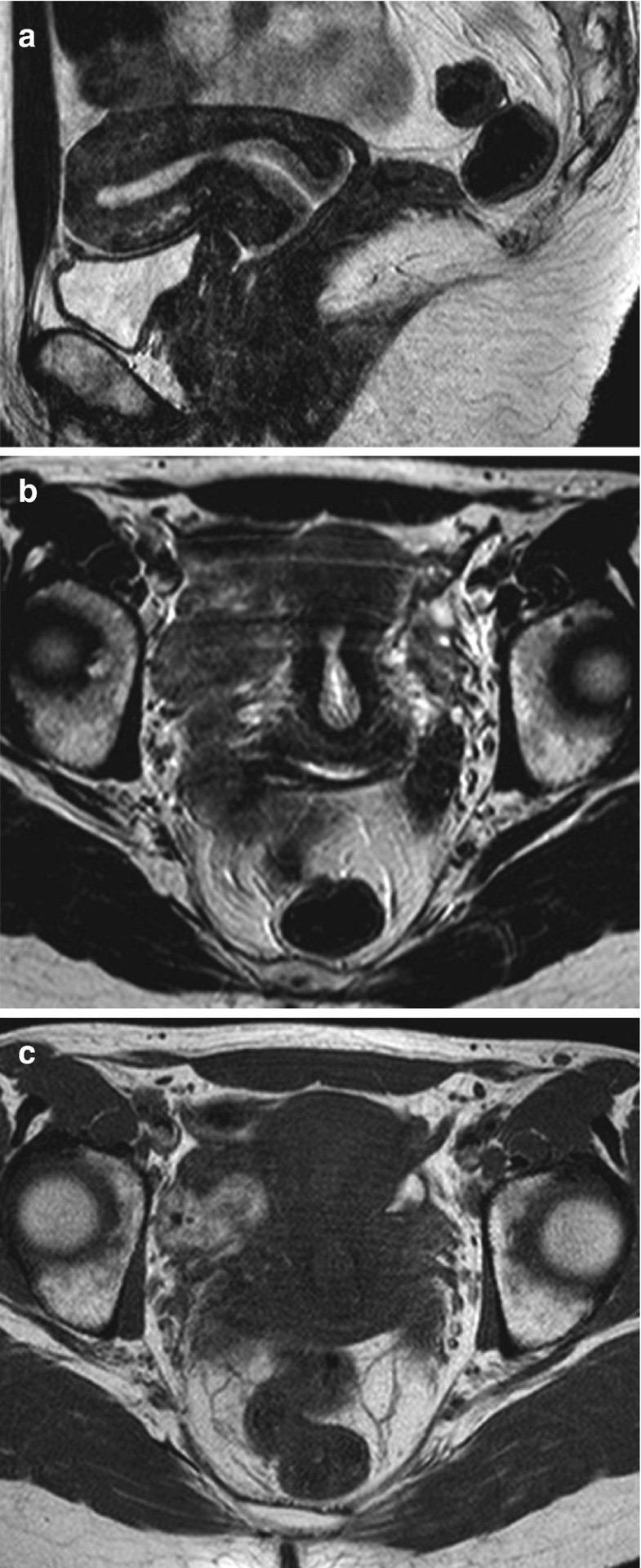 Uterus: Normal Findings | SpringerLink