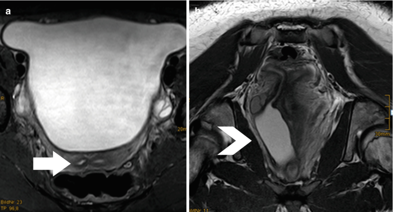 Vagina and Vulva | SpringerLink