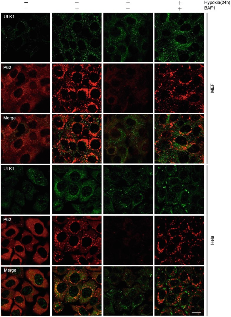 Immunofluorescence Staining Protocols for Major Autophagy Proteins ...