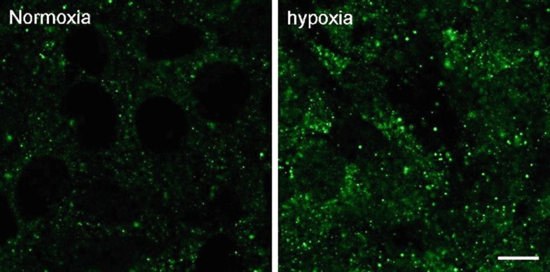 Immunofluorescence Staining Protocols for Major Autophagy Proteins ...