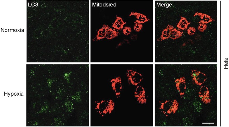 Immunofluorescence Staining Protocols for Major Autophagy Proteins ...