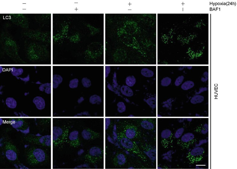 Immunofluorescence Staining Protocols for Major Autophagy Proteins ...