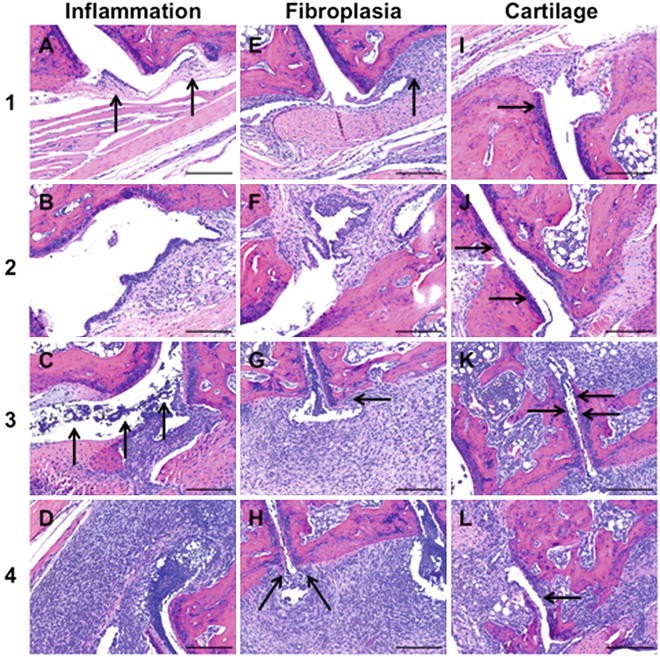 Histopathology in Mouse Models of Rheumatoid Arthritis | SpringerLink