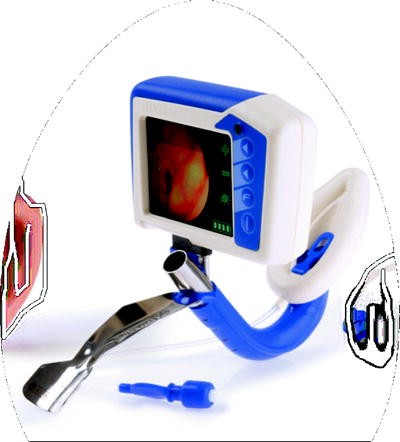 Advanced Airway Devices | SpringerLink