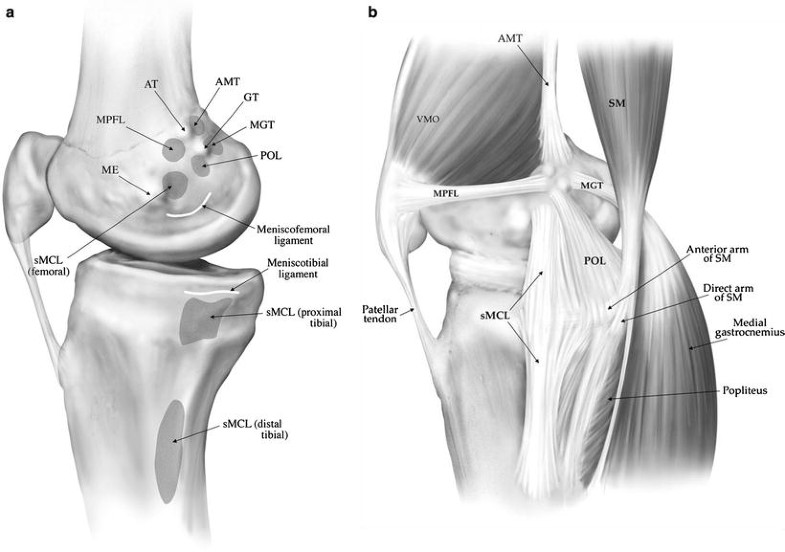 Surgical Treatment of Combined ACL and Medial-Sided Knee Injuries ...