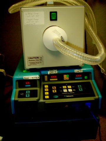 LEEP: Loop Electrosurgical Excision Procedure | SpringerLink