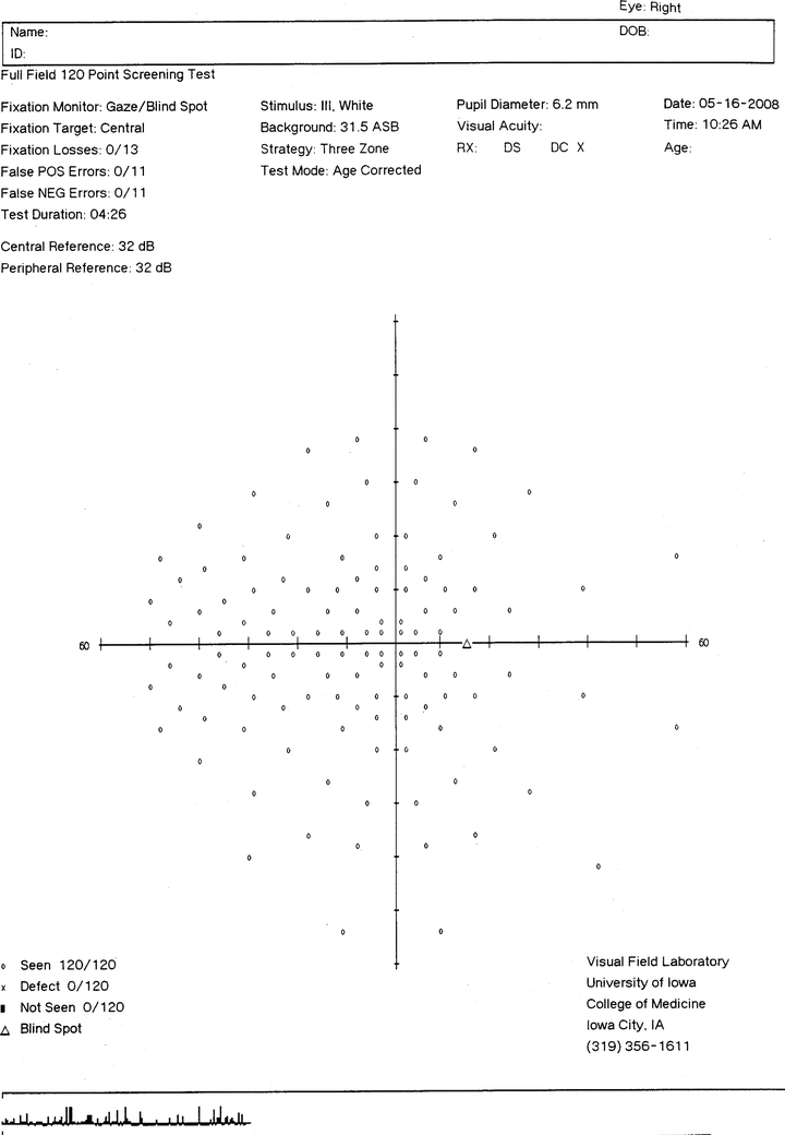 Detecting Functional Changes in the Patient’s Vision: Visual Field ...