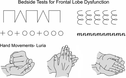 Frontal Lobe/Executive Functioning | SpringerLink